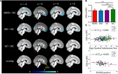 Frontiers | Reduced Gray Matter Volume in Orbitofrontal Cortex Across Schizophrenia, Major ...